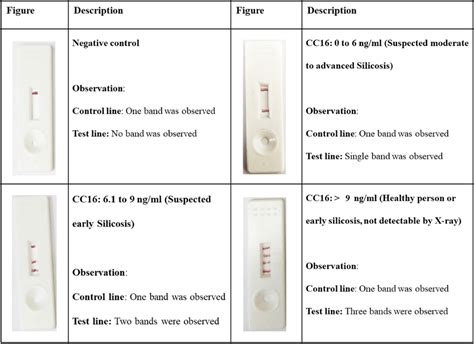 Detailed Description For Interpretation Of Results For Download Scientific Diagram