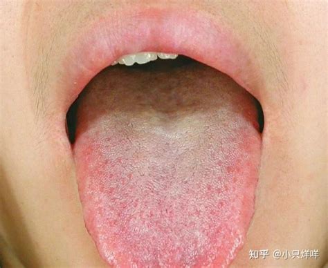 明明每天都刷牙为什么还是口臭口臭用什么比较好 知乎