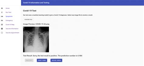 Senior Design Journey 2021 Using Lung Scans And Algorithms To Diagnose