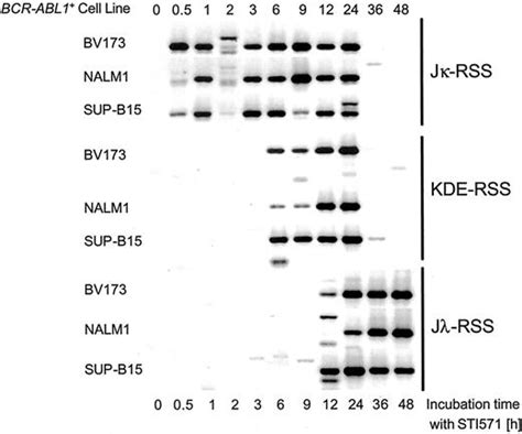 Tracing The Pre B To Immature B Cell Transition In Human Leukemia Cells Reveals A Coordinated