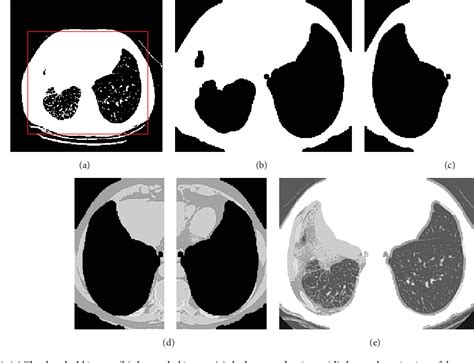 Figure 1 From Statistical Analysis Of Haralick Texture Features To