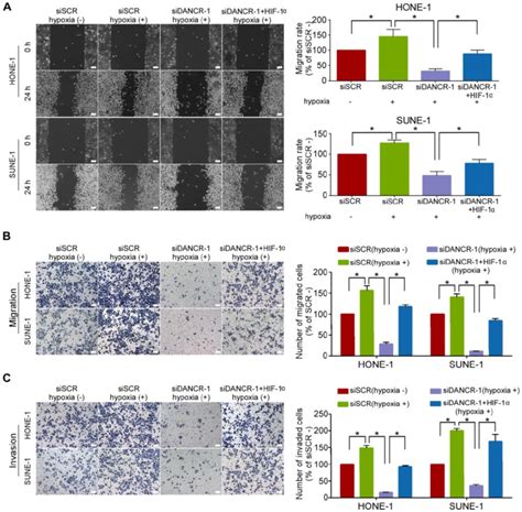 LncRNA DANCR promotes NPC cell migration and invasion via HIF α A C Download Scientific