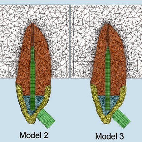 Finite Element Models Note The Reproduction Of All Its Components Download Scientific Diagram