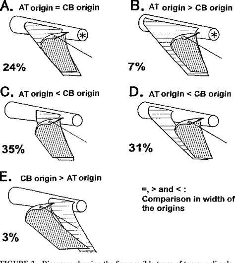 Tensor Veli Palatini Origin And Insertion