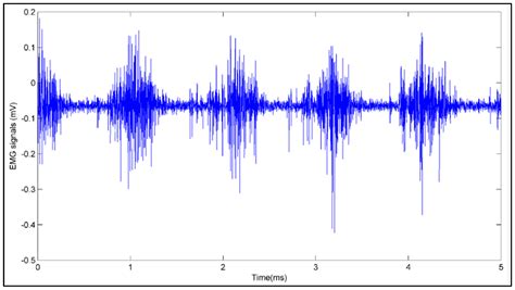 Enhanced Hand Gesture Recognition With Surface Electromyogram And Machine Learning