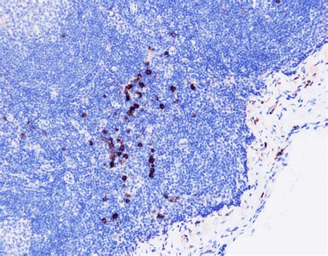 Syndecan 1cd138 Antibody B A38 Nb100 64980 Novus Biologicals