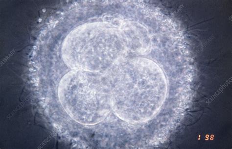 Lm Of Human Embryo At Four Cell Stage Stock Image P6800205