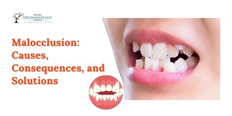 Understanding Malocclusion Causes Consequences And Solutions