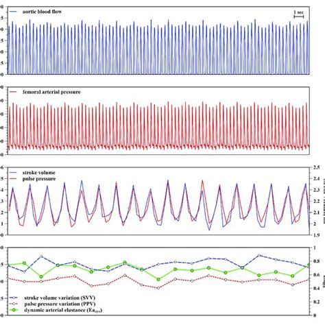 Calculation Of Pulse Pressure Variation Ppv Stroke Volume Download Scientific Diagram