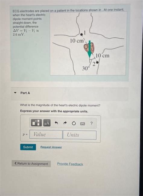 Solved Ecg Electrodes Are Placed On A Patient In The