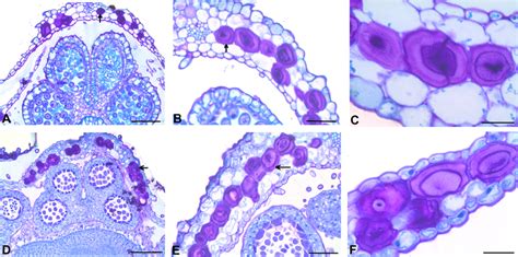 Mucilage Cells In The Flowers Of Cannabaceae Species Staminate Flower Download Scientific