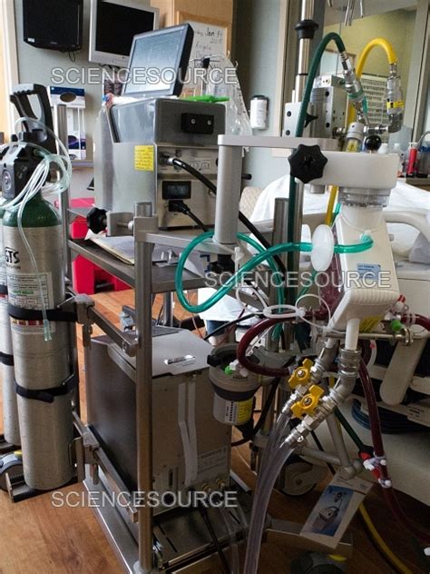 Extracorporeal Membrane Oxygenation E Stock Image Science Source