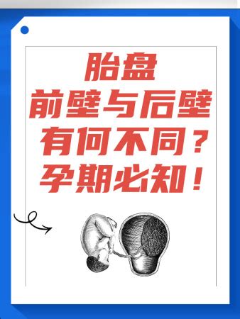 胎盘前壁与后壁有何不同孕期必知
