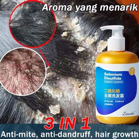 Anti Dandruff Shampoo 300ml Selenium Disulfide Dandruff Syampu Rambut Kelemumur Kepala Psoriasis Anti Dandruff Shampoo 300ml Selenium Disulfide Dandruff Syampu Rambut Kelemumur Kepala Psoriasis