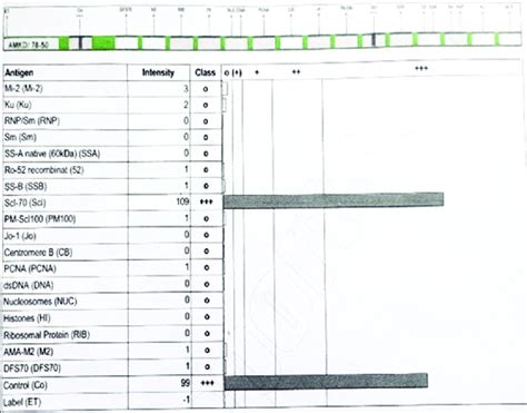 Laboratory Report Of Scl 70 Antigen Download Scientific Diagram