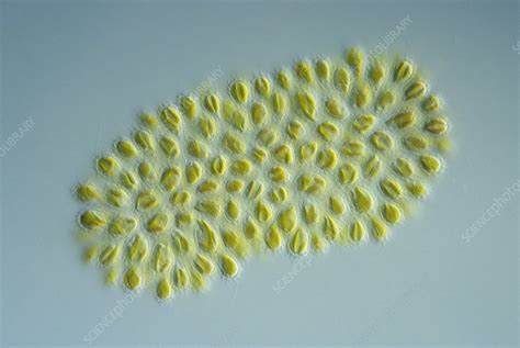 A Colony Of Chrysophytes Stock Image C012 6693 Science Photo Library