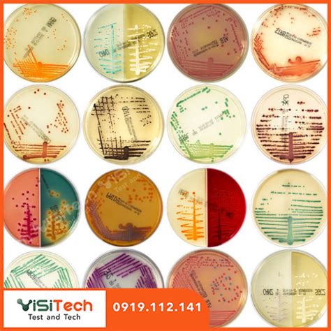 Môi Trường Nuôi Cấy Vi Khuẩn Sinh Màu Chromogenic Medium