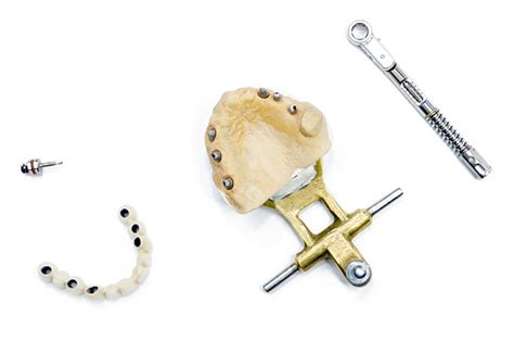 흰색 배경에 치과 임플란트가있는 흰색 세라믹 치아 토크 렌치 및 치과 드라이버 임플란트에 치과 이식 및 정형 외과 의개념 건강관리와 의술에 대한 스톡 사진 및 기타 이미지