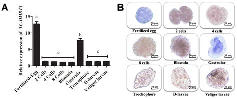 A Testis Specific DMRT1 Double Sex And Mab 3 Related Transcription Factor 1 Plays A Role In