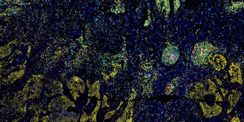 Multiplex Ihc Uses Of Multiplex Immunohistochemical Kits