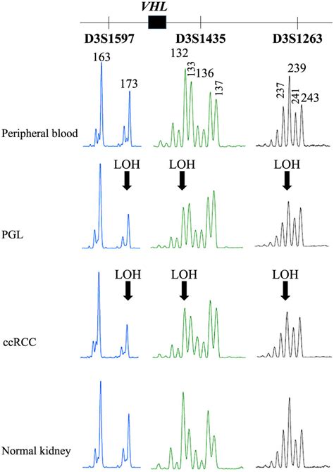 Polymorphic Microsatellite Analysis Of The Von Hippellindau Locus