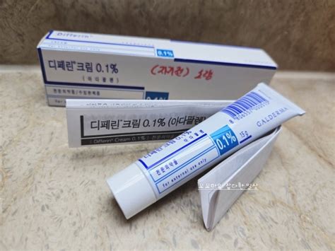 사춘기여드름 피부과처방약 여드름연고 디페린크림 사용후기 네이버 블로그