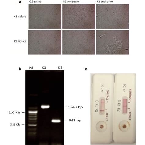 Pulsed Field Gel Electrophoresis Pfge Analysis Of K Pneumoniae