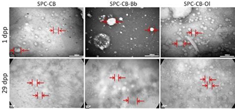 Solid Lipid Microparticles As Carriers Of Vaccinium Myrtillus And Schinus Molle Linn Additives