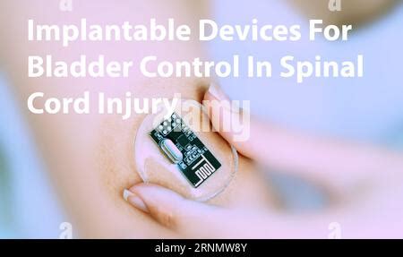 Implantable Neurostimulation For Bladder Control Devices That Deliver Electrical Impulses To