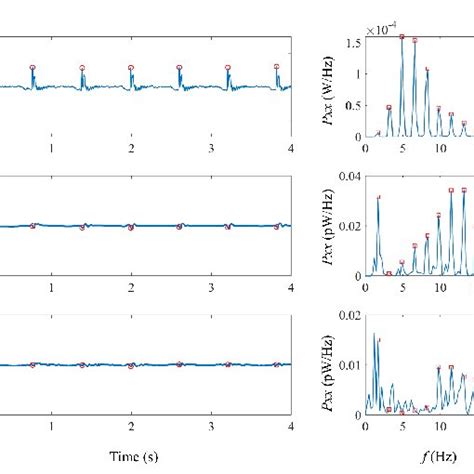Pdf Removal Of Ecg Artifacts From Eeg Using An Effective Recursive Least Square Notch Filter