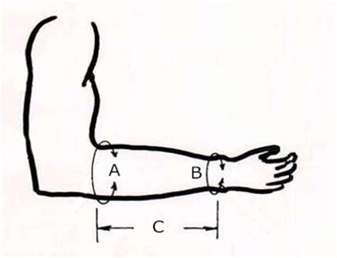 Kit Contains A Single Bracer Sleeve For One Arm This Bracer Kit Was