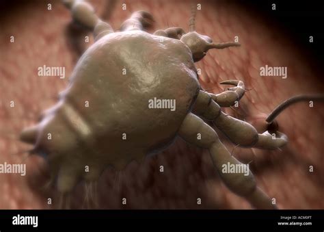 Pidocchio Pubico Immagini E Fotografie Stock Ad Alta Risoluzione Alamy