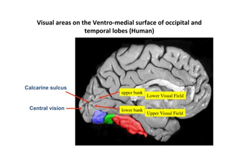 Lec 13 Visual Cortex 1 Cell Types And Orientation Selectivity