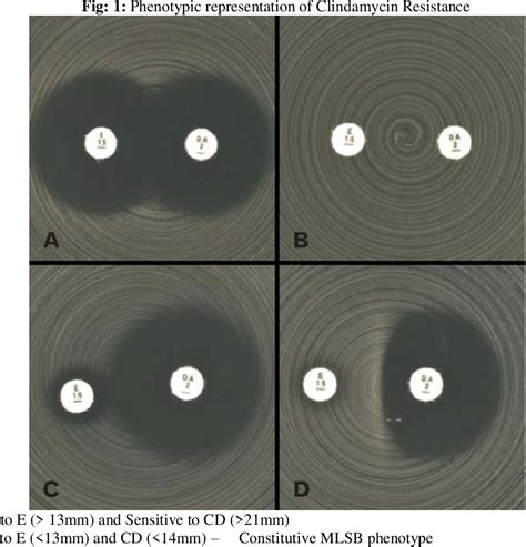 Figure 1 From “prevalence Of Inducible Resistance To Clindamycin In Staphylococcus Aureus Using