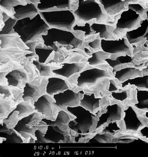 Thin Walled Endosperm Cells After The Removal Of Starch Granules Download Scientific Diagram