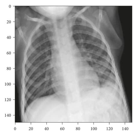the falsely classified x ray image download scientific diagram