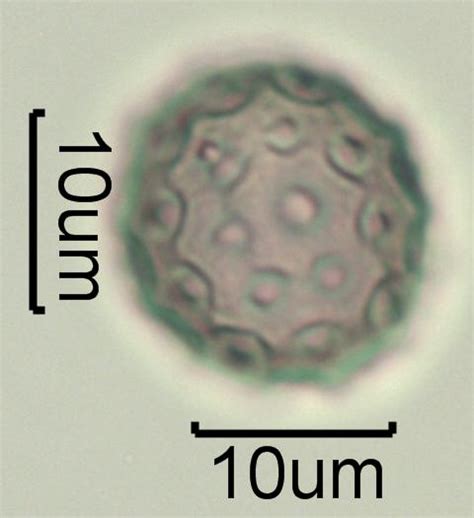 Pollen From Western Washington Clover Honey Under The Microscope