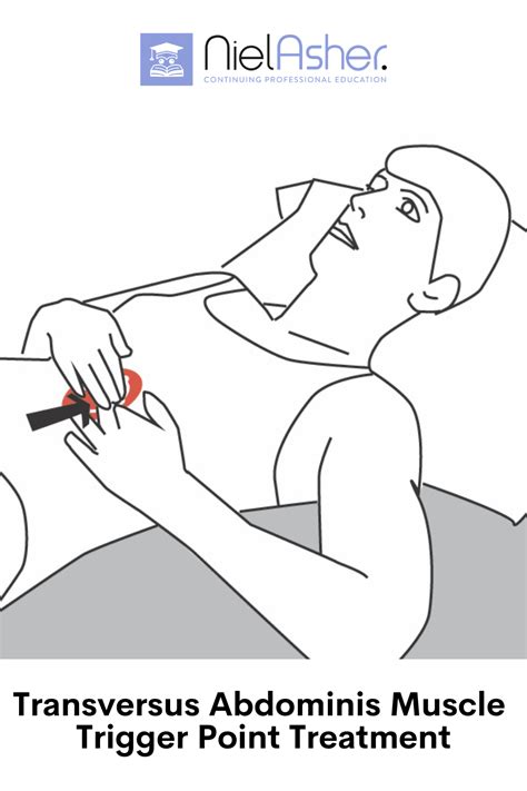 Trigger Point Therapy Treating Pectoralis Major Artofit