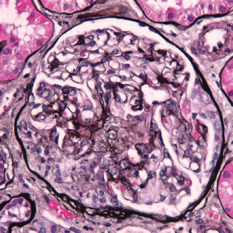 Immunofluorescence Linear Staining Of Igg Download Scientific Diagram