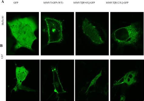 Mutations In Slc5a6 Associated With Brain Immune Bone And Intestinal