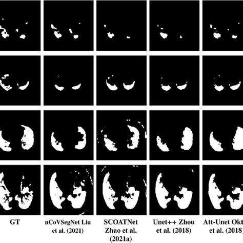 visual comparison of a segmentation model trained with different download scientific diagram