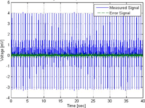 Figure 3 From Fetal Heart Monitoring From Maternal Ecg Semantic Scholar