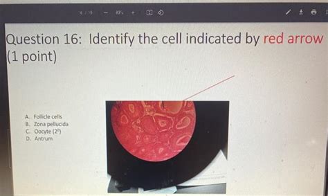 Solved 30 83 Question 13 Identify The Cell Indicated By Red