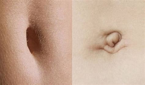 Почему у одних людей пупок выпуклый а у других — впалый в 2024 г