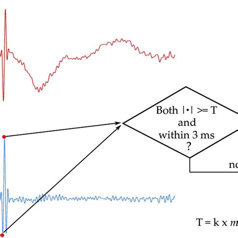 The Pacemaker Spike Detection Algorithm Proposed By Herleikson 31