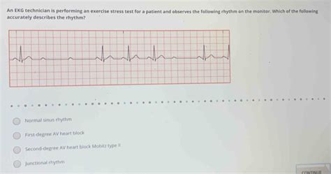 Solved An Ekg Technician Is Performing An Exercise Stress Test For A