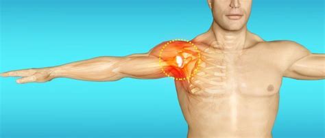 Diagnosis Of Shoulder Joint Pain Fidias