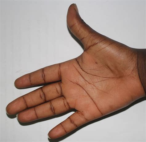 Palm Detection Palm Detection Ekp8l Roboflow Universe