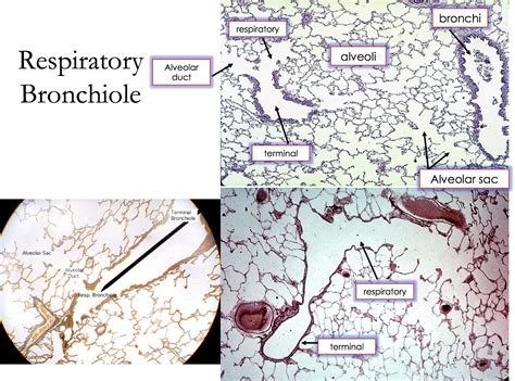 Respiratory Bronchioles Labeled