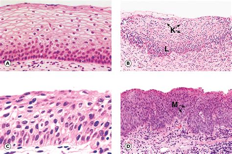 Female Reproductive System Clinical Tree
